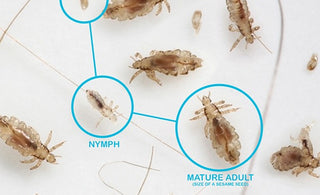 How to solve the problem of headlice – LiceDoctors