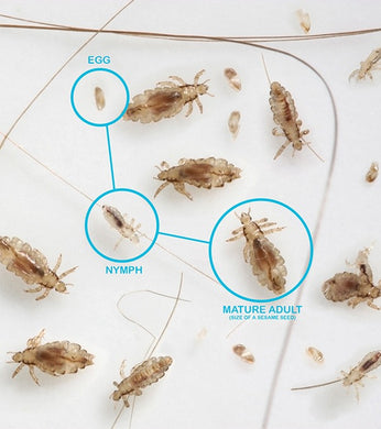 How to solve the problem of headlice – LiceDoctors