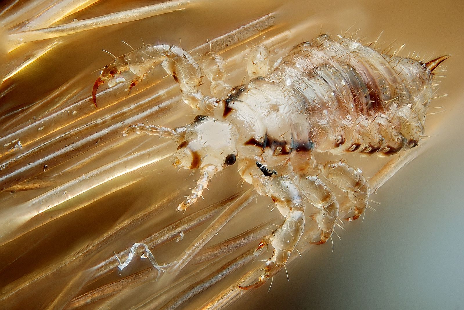 The Economic Impact of Head Lice: How Infestations Affect Families and ...